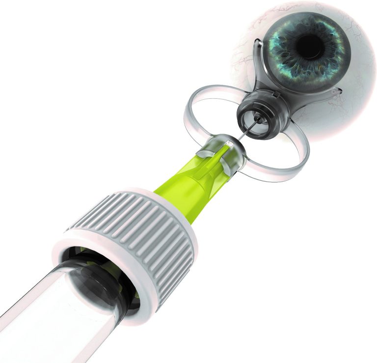 SP.eye™ - Andersen Caledonia